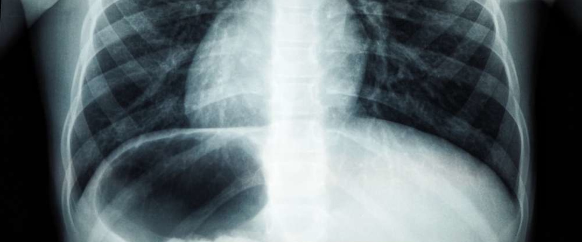 How Medical Imaging is Used to Detect Abnormalities in the Body