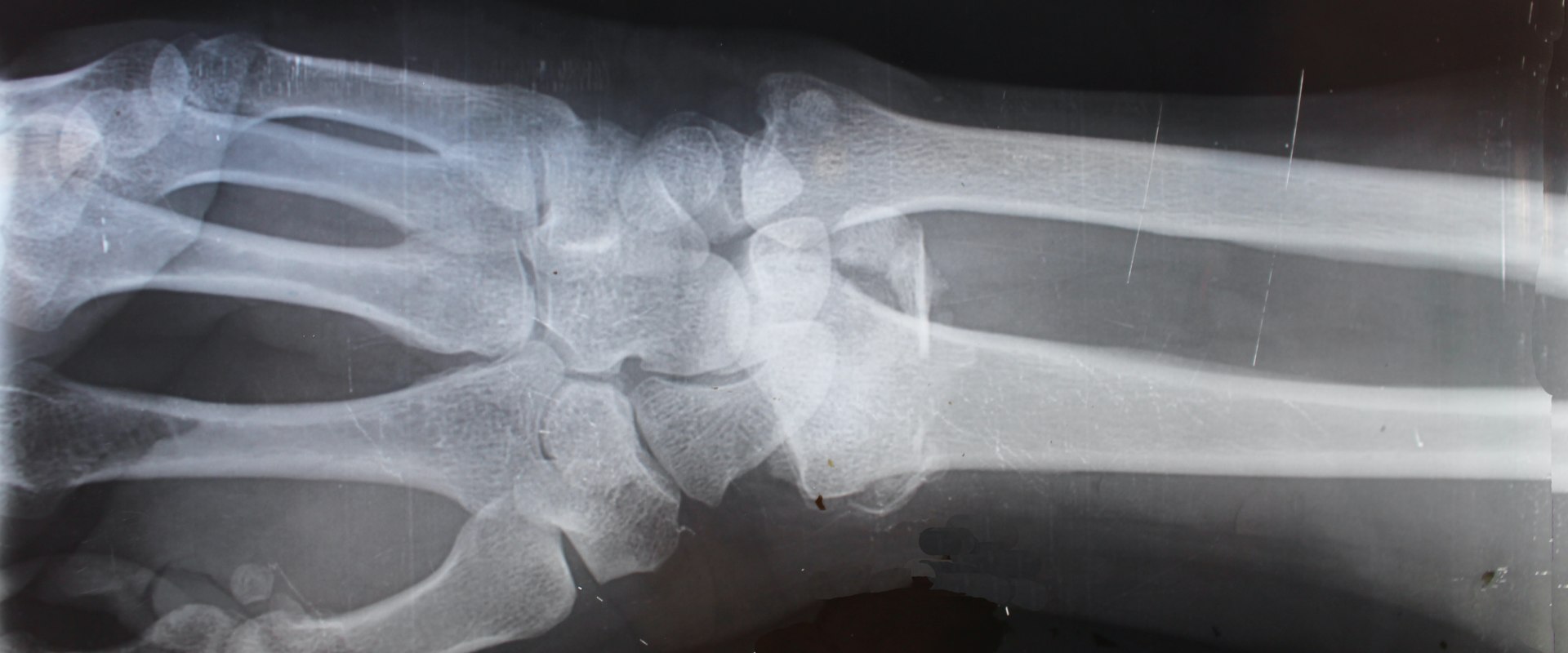 Exploring the Different Types of Medical Imaging